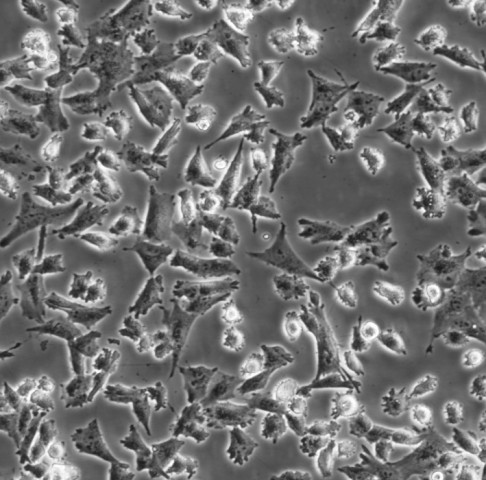 PATU8988T细胞;人胰腺癌细胞_人源_细胞系_U平台商城-普拉特泽生物 - Powered by ECShop